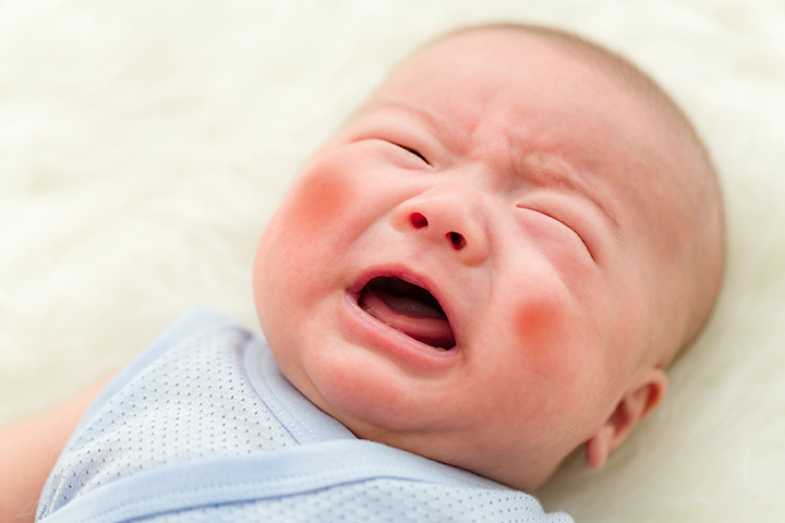 ᐅ Ecchymoses chez les nourrissons et les enfants: tout ce que vous ...