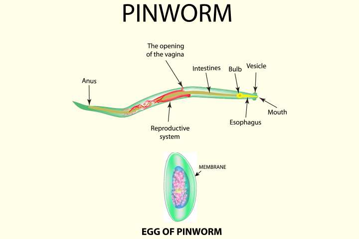 ᐅ Infection par les oxyures pendant la grossesse: causes, diagnostic et ...
