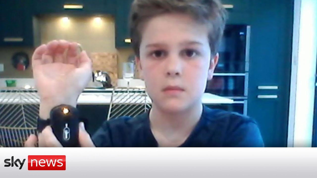 ᐅ Sluta med tics: 7 effektiva metoder för ett lugnare liv